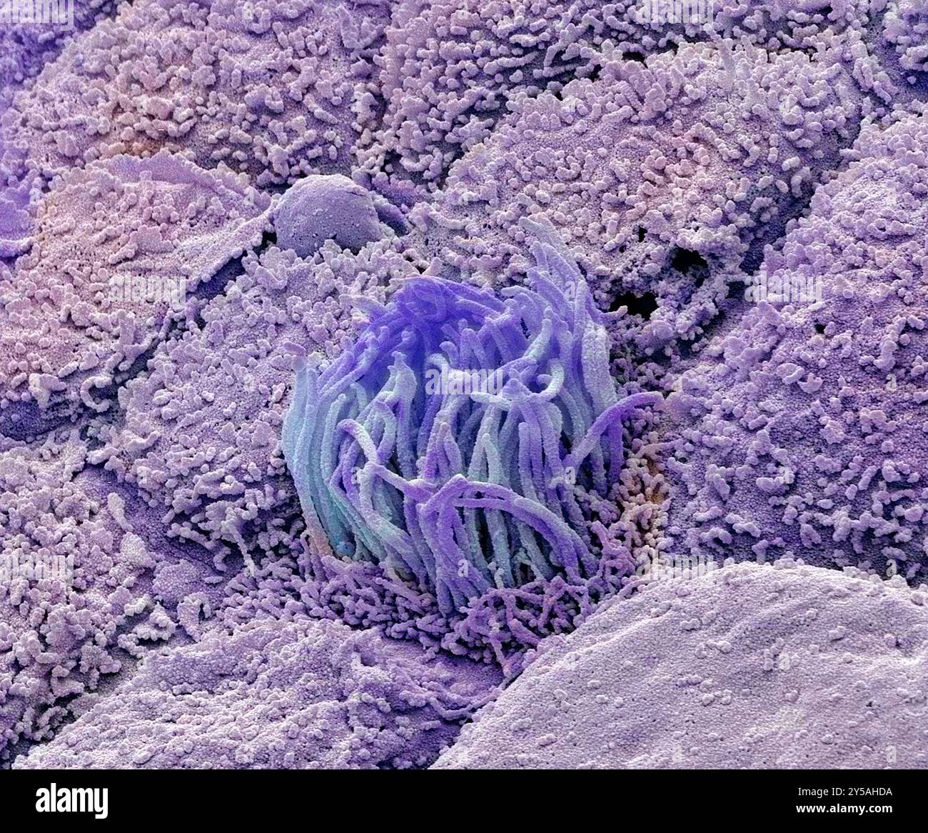 Uterus (mid-secretory stage). Coloured scanning electron micrograph ...