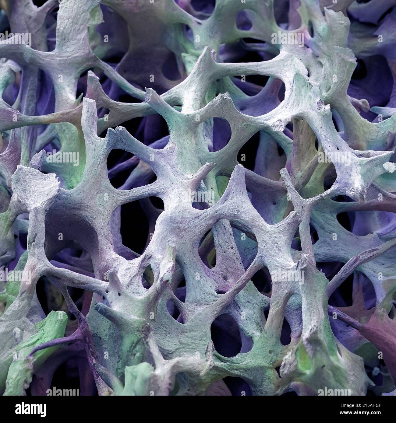 Bone tissue. Coloured scanning electron micrograph (SEM) of cancellous ...