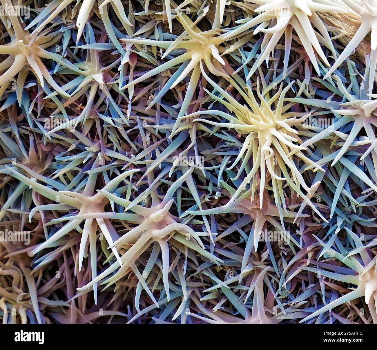 Abutilon leaf trichomes. Scanning electron micrograph of trichomes from ...