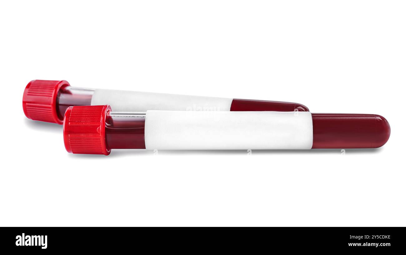 Blood in test tubes with blank labels on white background. Medical ...