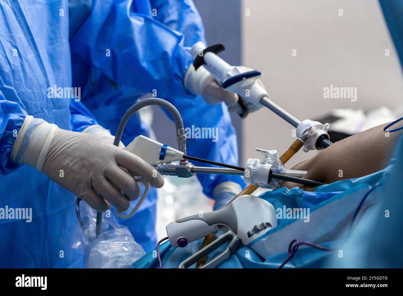 Doctor performing laparoscopic keyhole, bariatric surgery, gastric sleeve, gastric bypass ...