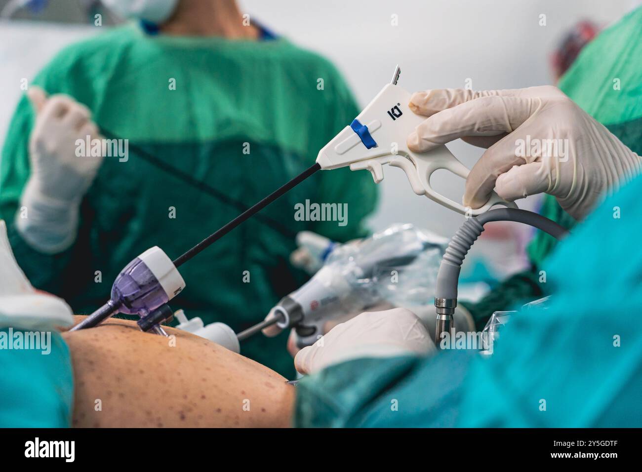 Doctor performing laparoscopic keyhole, bariatric surgery, gastric ...