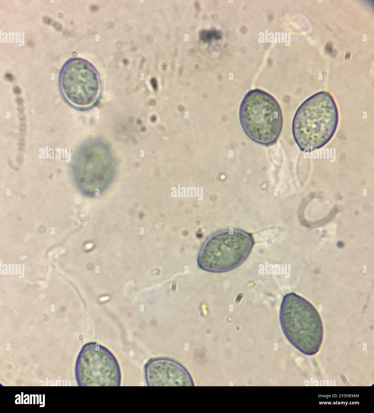 (Podospora araneosa) Fungi Stock Photo - Alamy