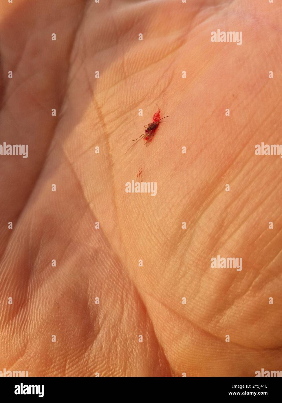 Squashed mosquito on the palm of a hand Stock Photo - Alamy