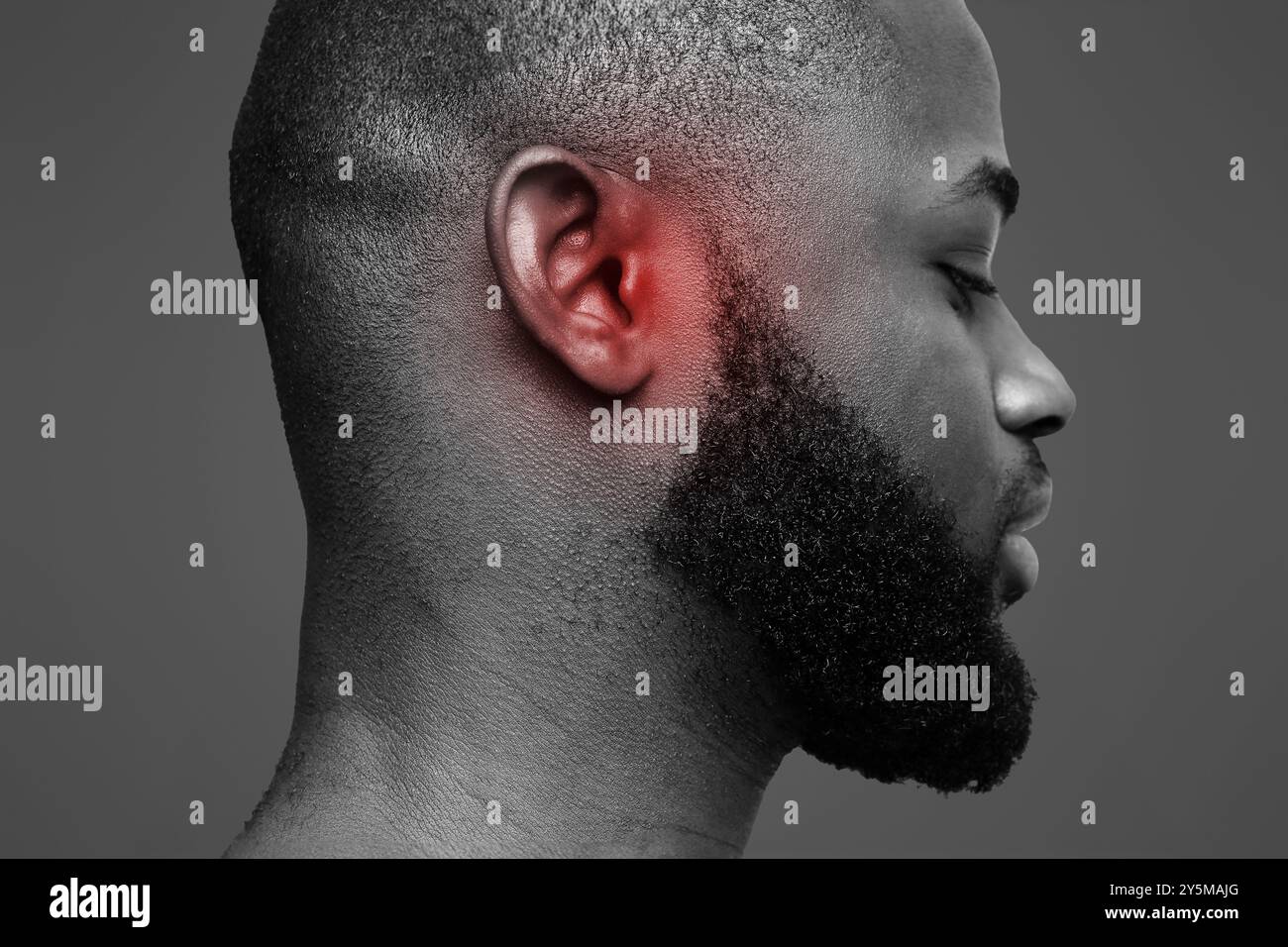 Black guy with inflamed ear, side view Stock Photo - Alamy