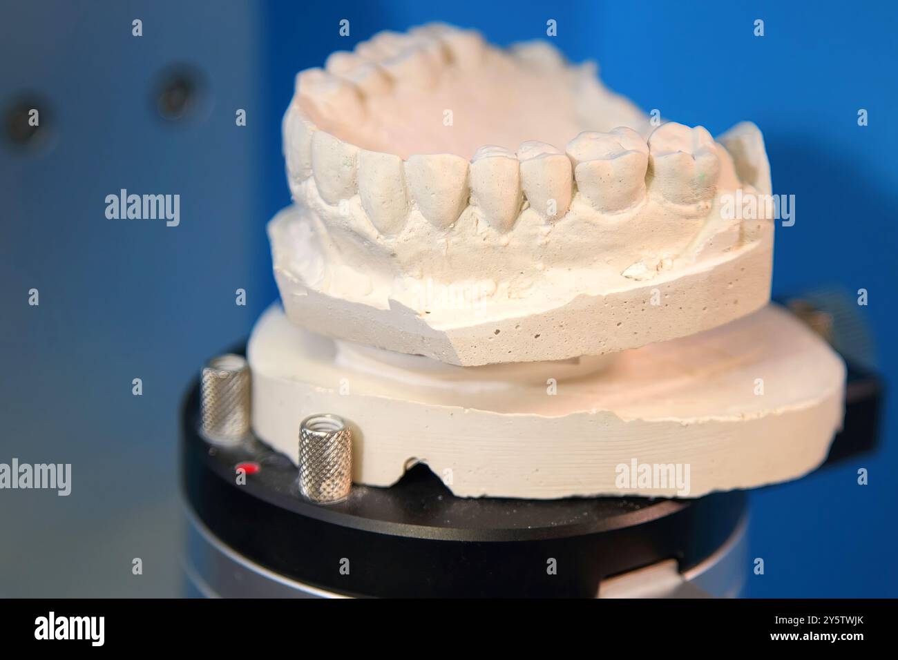 Ceramic dental crowns for implants. Fabrication of dental crowns and ...