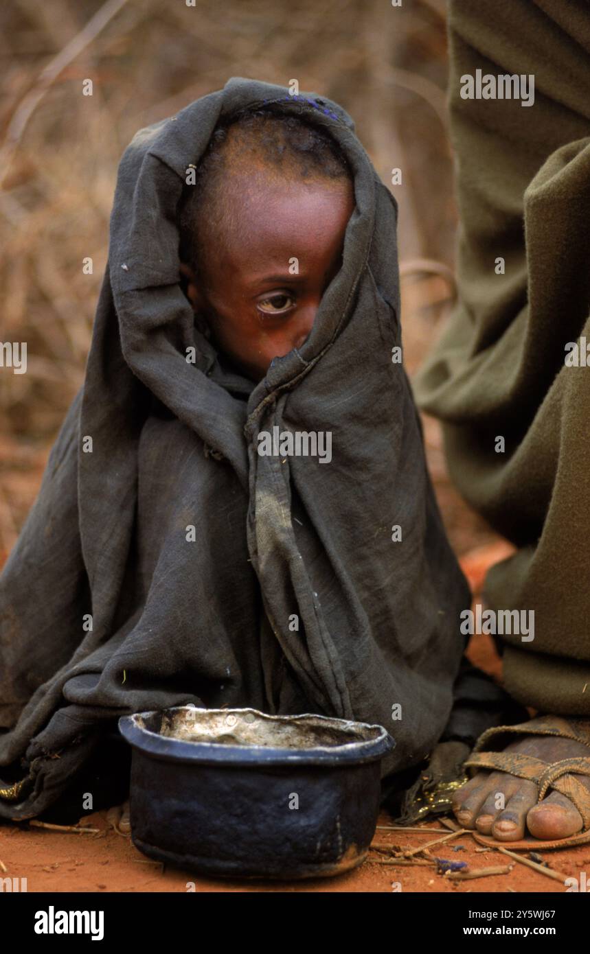 Starving Boy in Baidoa Stock Photo - Alamy