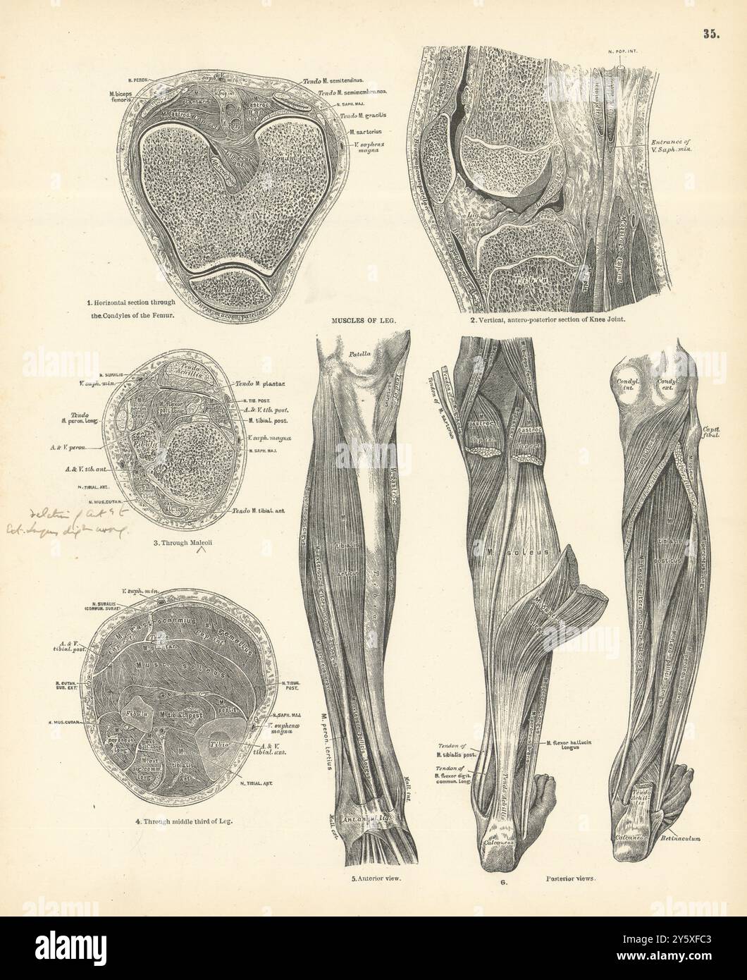Anatomy. Muscles of Leg 1880 old antique vintage print picture Stock ...