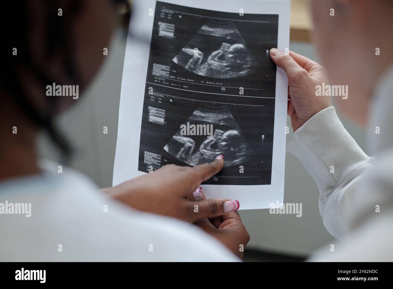 Healthcare professional holding and showing ultrasound images during ...