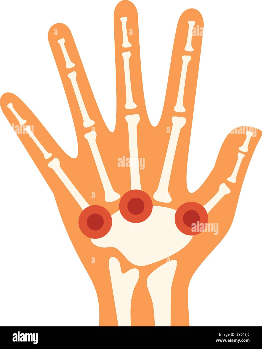 Rheumatoid arthritis and painful human condition hi-res stock ...