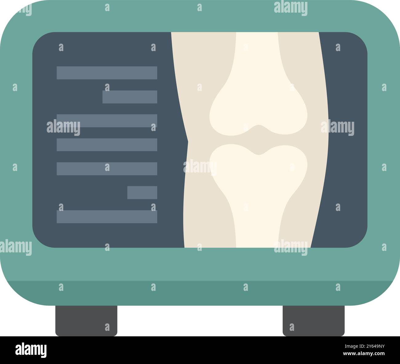 X ray machine is showing knee bones scan result on a monitor screen ... X ray machine is showing knee bones scan result on a monitor screen ...