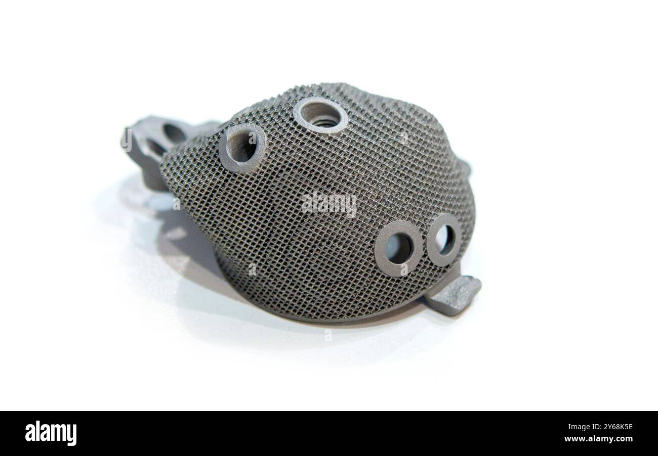 Implant of joint printed on a 3D printer from biocompatible titanium ...