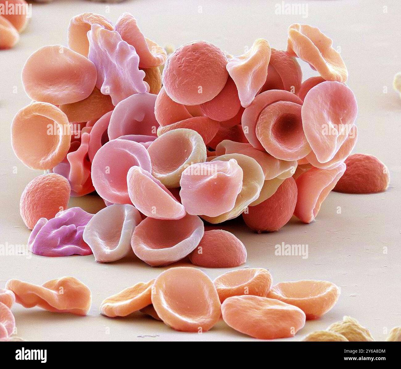 Red blood cells. Coloured scanning electron micrograph (SEM) of red ...