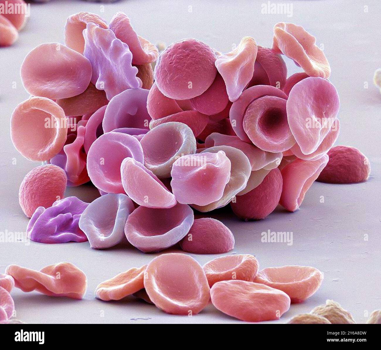 Red blood cells. Coloured scanning electron micrograph (SEM) of red ...
