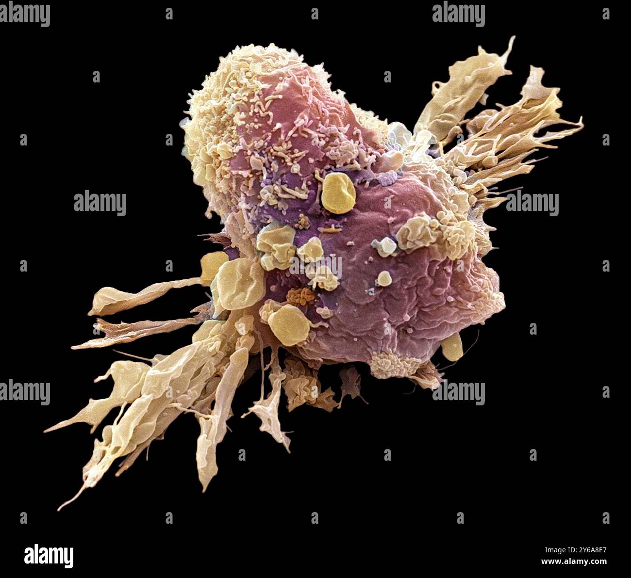 Colorectal cancer cell, SEM Stock Photo - Alamy