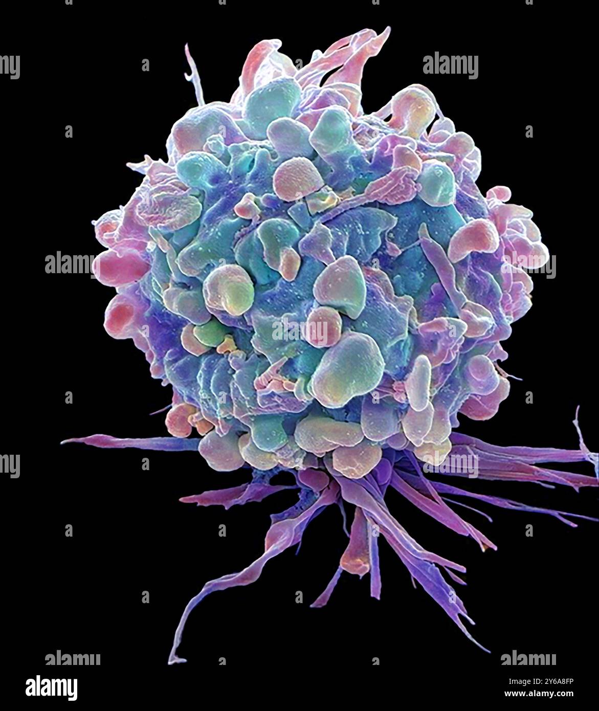 Chemotherapy induced cell death, SEM Stock Photo - Alamy