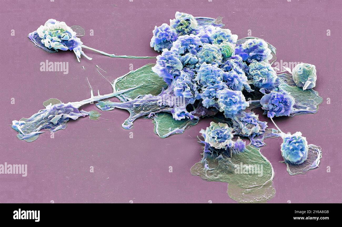 Activated granulocytes. Coloured scanning electron micrograph (SEM) of ...