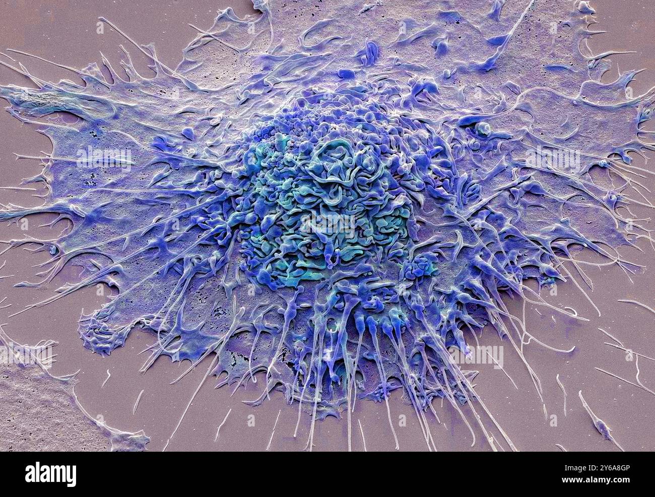 Macrophage. Coloured scanning electron micrograph (SEM) of an activated macrophage white blood ...