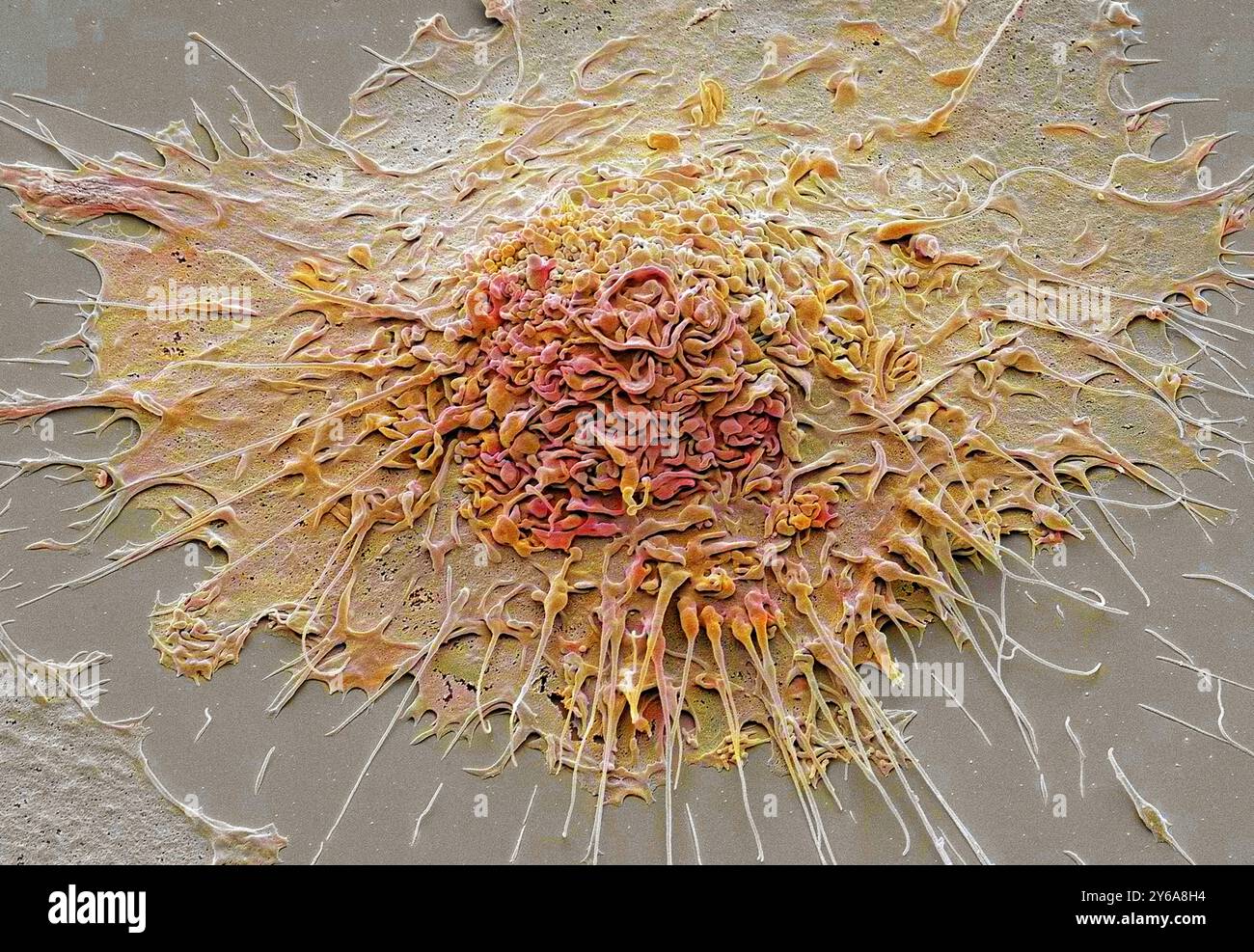 Macrophage. Coloured scanning electron micrograph (SEM) of an activated macrophage white blood ...