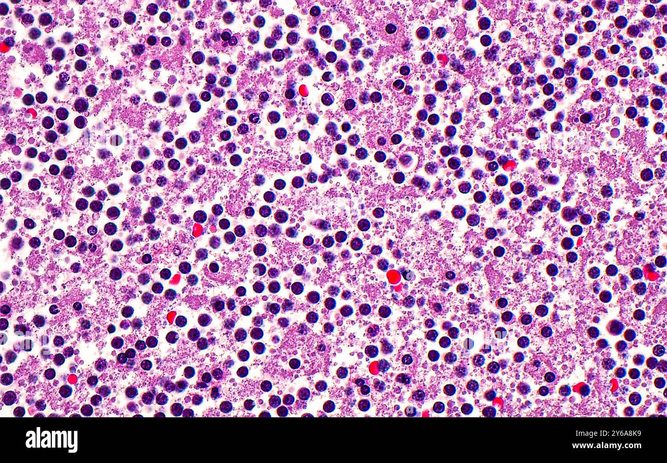 Light micrograph of lymphocytes and other blood cells. The lymphocytes ...