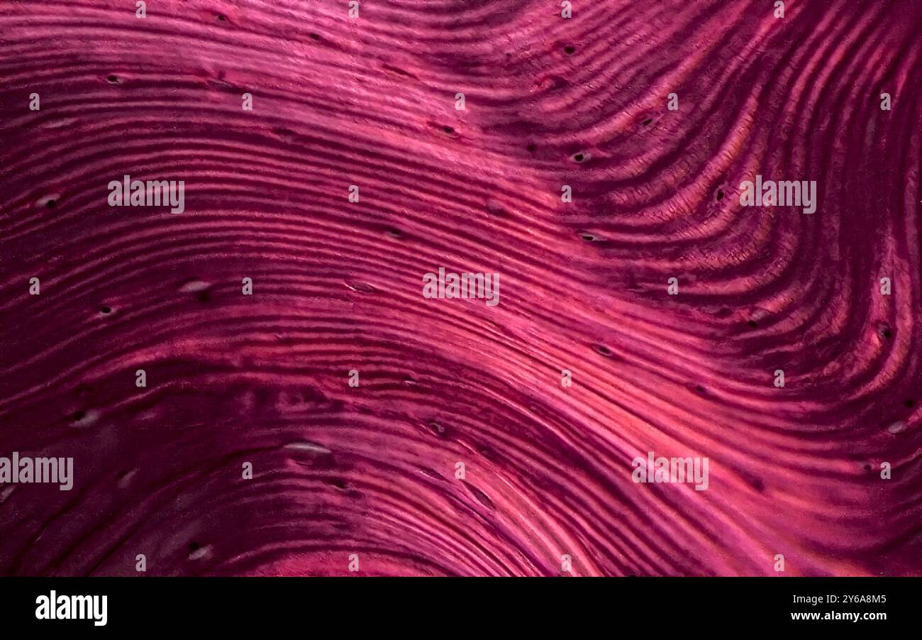 Light micrograph of lamellar bone. Lamellar bone is made up of layers ...