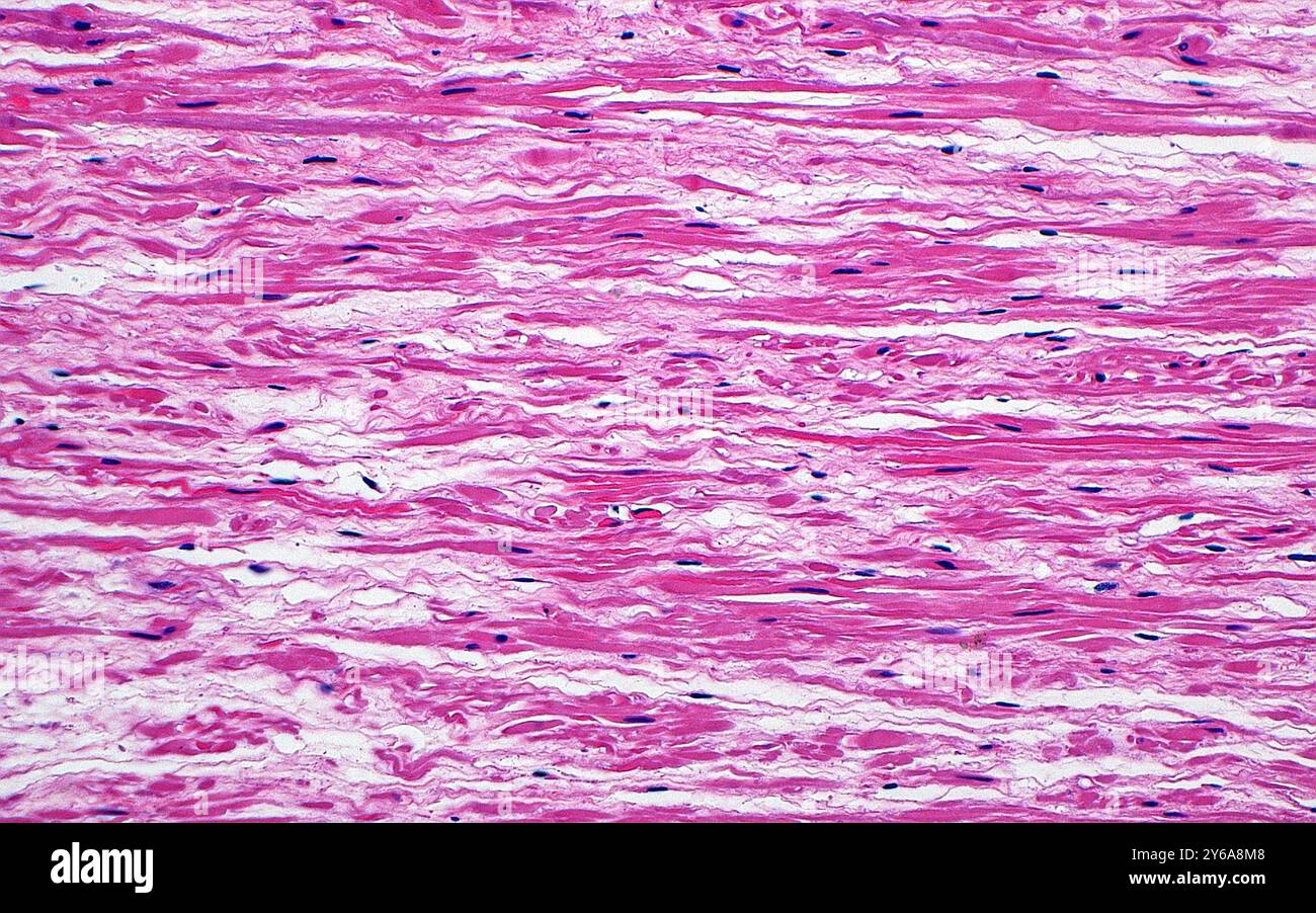 Light micrograph of prostatic fibromuscular stroma. The stroma is the ...