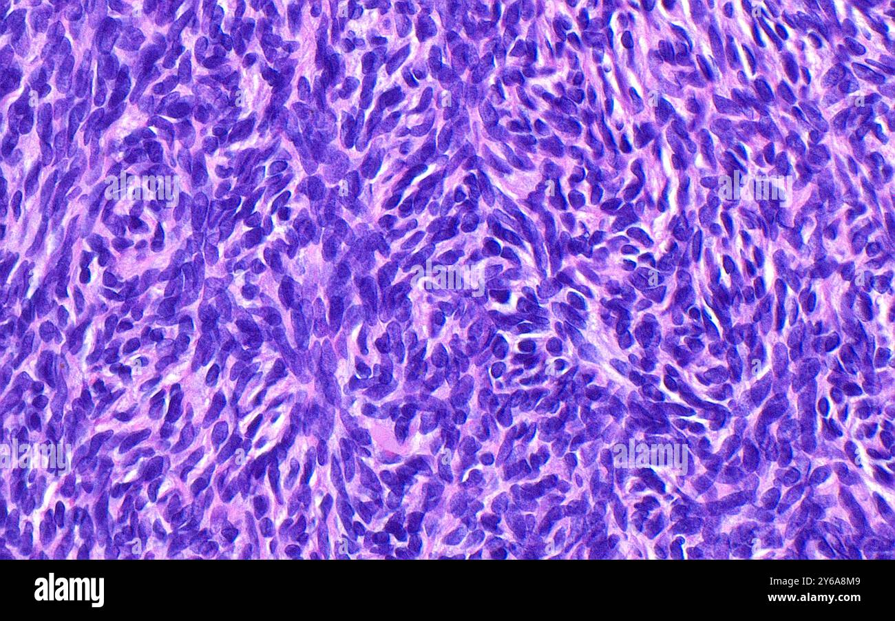 Light micrograph of ovarian stroma. The stromal cells are the ...