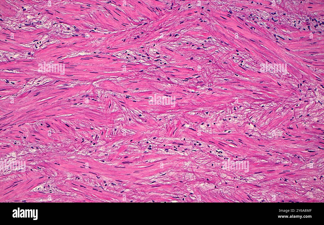 Light micrograph of prostatic fibromuscular stroma. The stroma is the ...