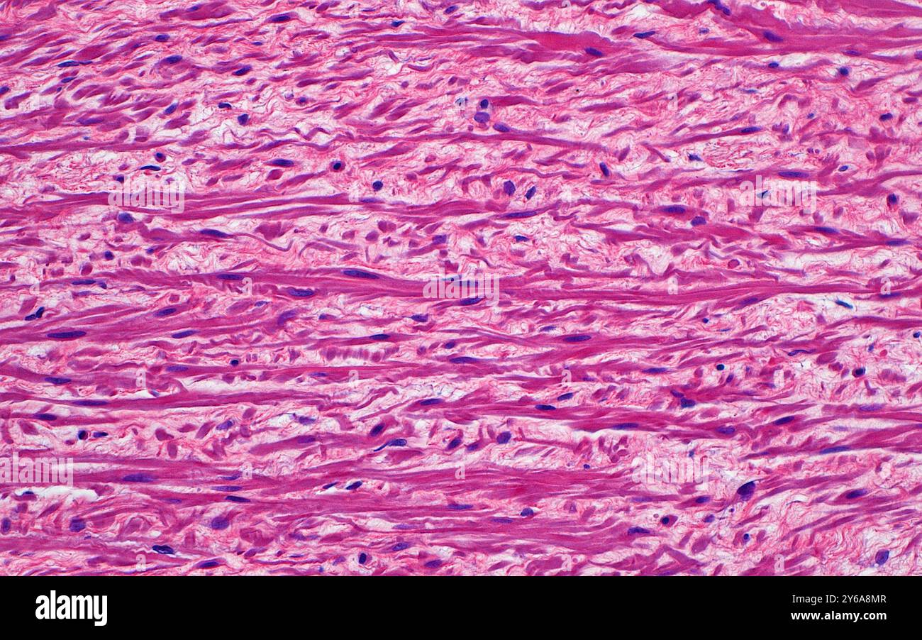 Light micrograph of prostatic fibromuscular stroma. The stroma is the ...