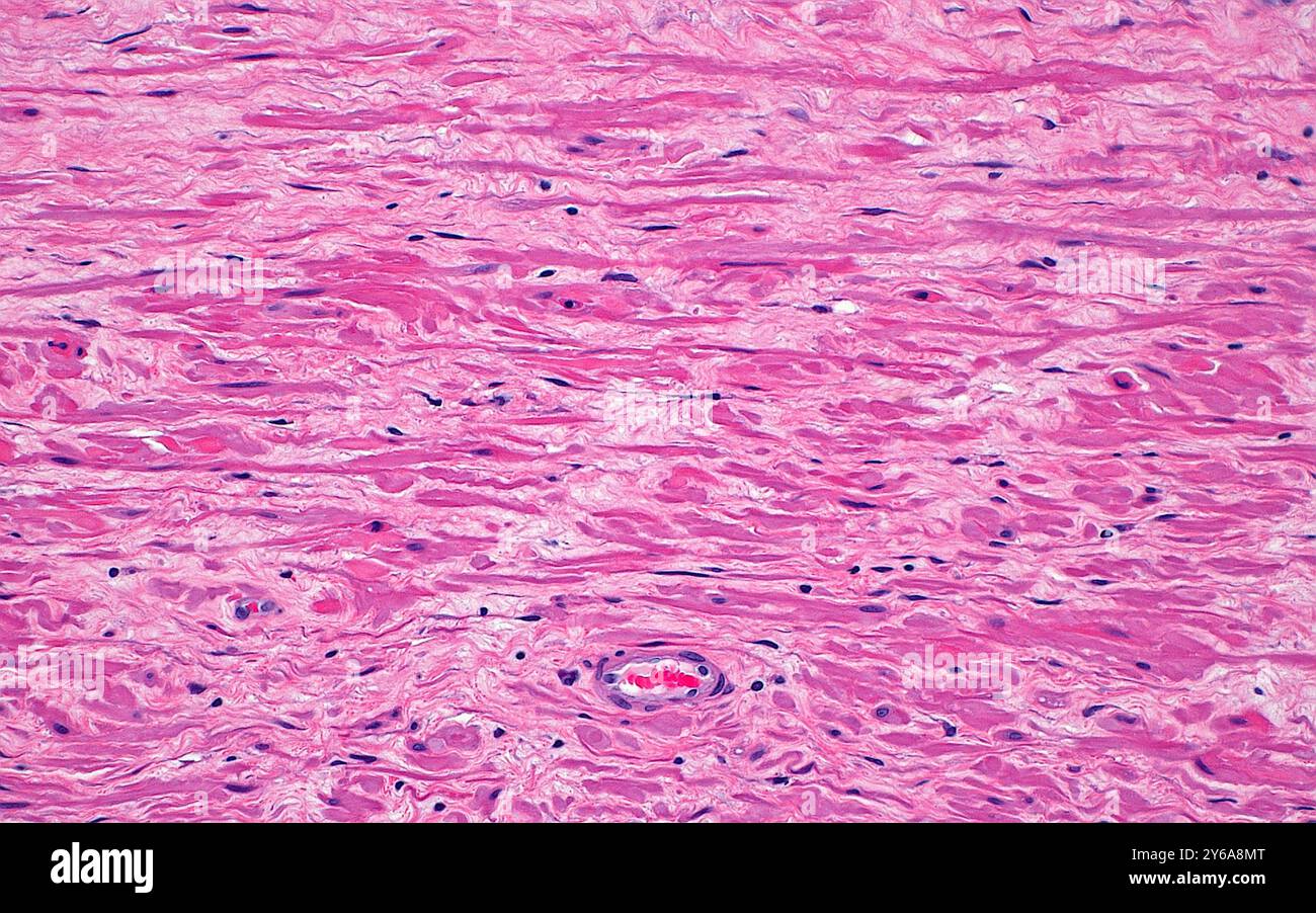 Light micrograph of prostatic fibromuscular stroma. The stroma is the ...