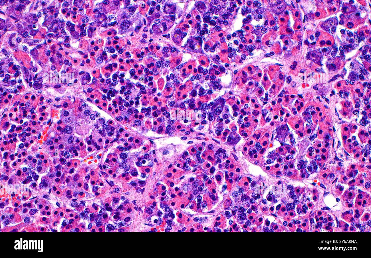 Light micrograph of pituitary gland. The pituitary gland includes ...