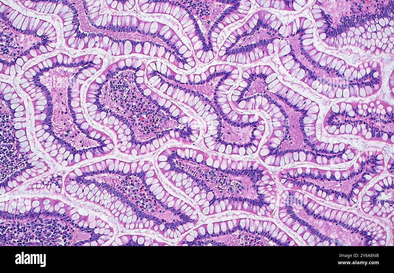 Light micrograph of cross sections of small bowel villi. Haematoxylin ...