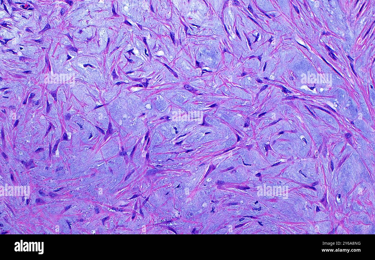 Light micrograph of the intimal layer of a renal vein. The intima is ...