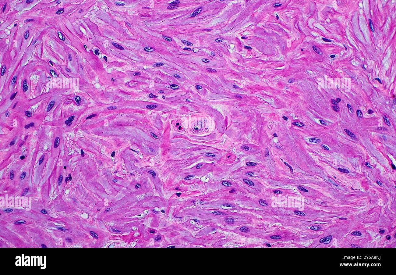 Light micrograph of smooth muscle In the wall of a seminal vesicle. The ...