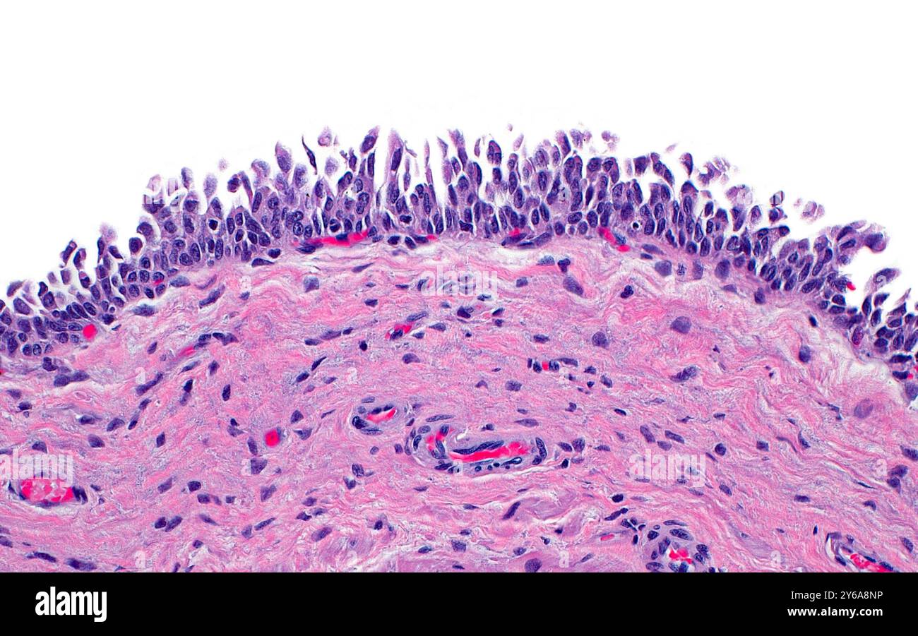 Light micrograph of urothelial cells. The urothelial cells (blue and ...