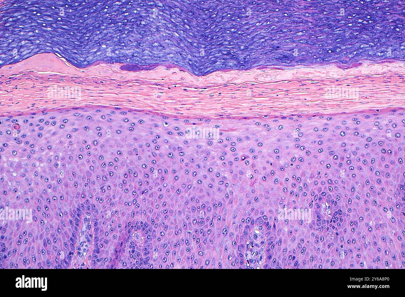 Light micrograph of acral skin. Acral skin is skin of the non-hair ...