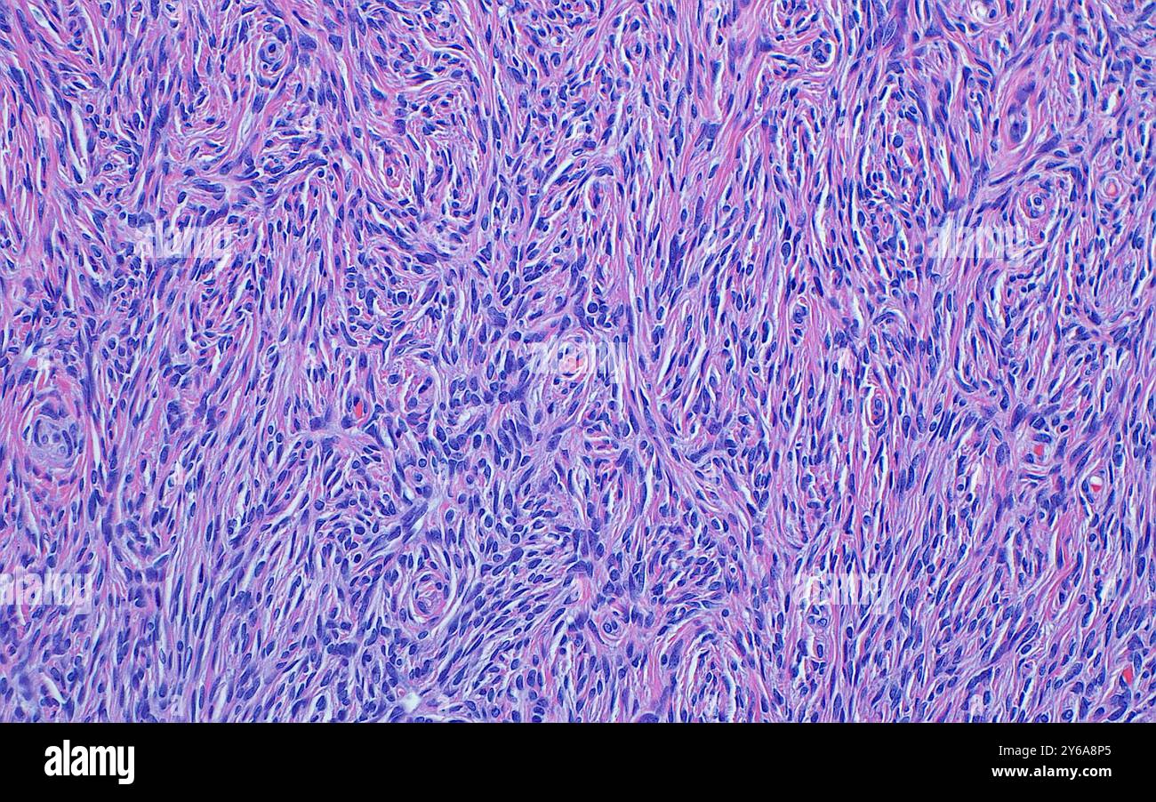 Light micrograph of ovarian stroma. The stromal cells are the ...