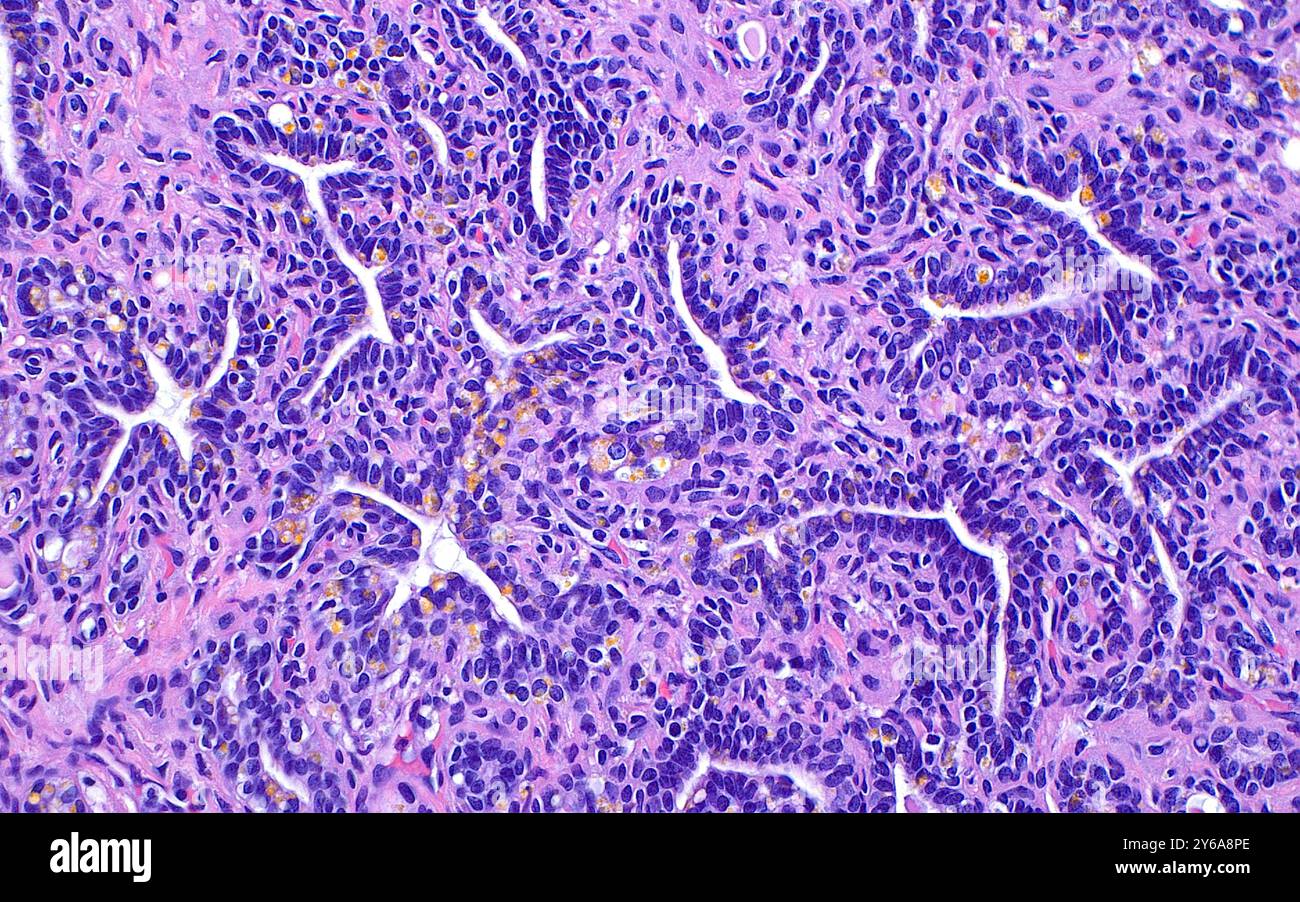 Light micrograph of the epithelium of a seminal vesicle. The seminal ...