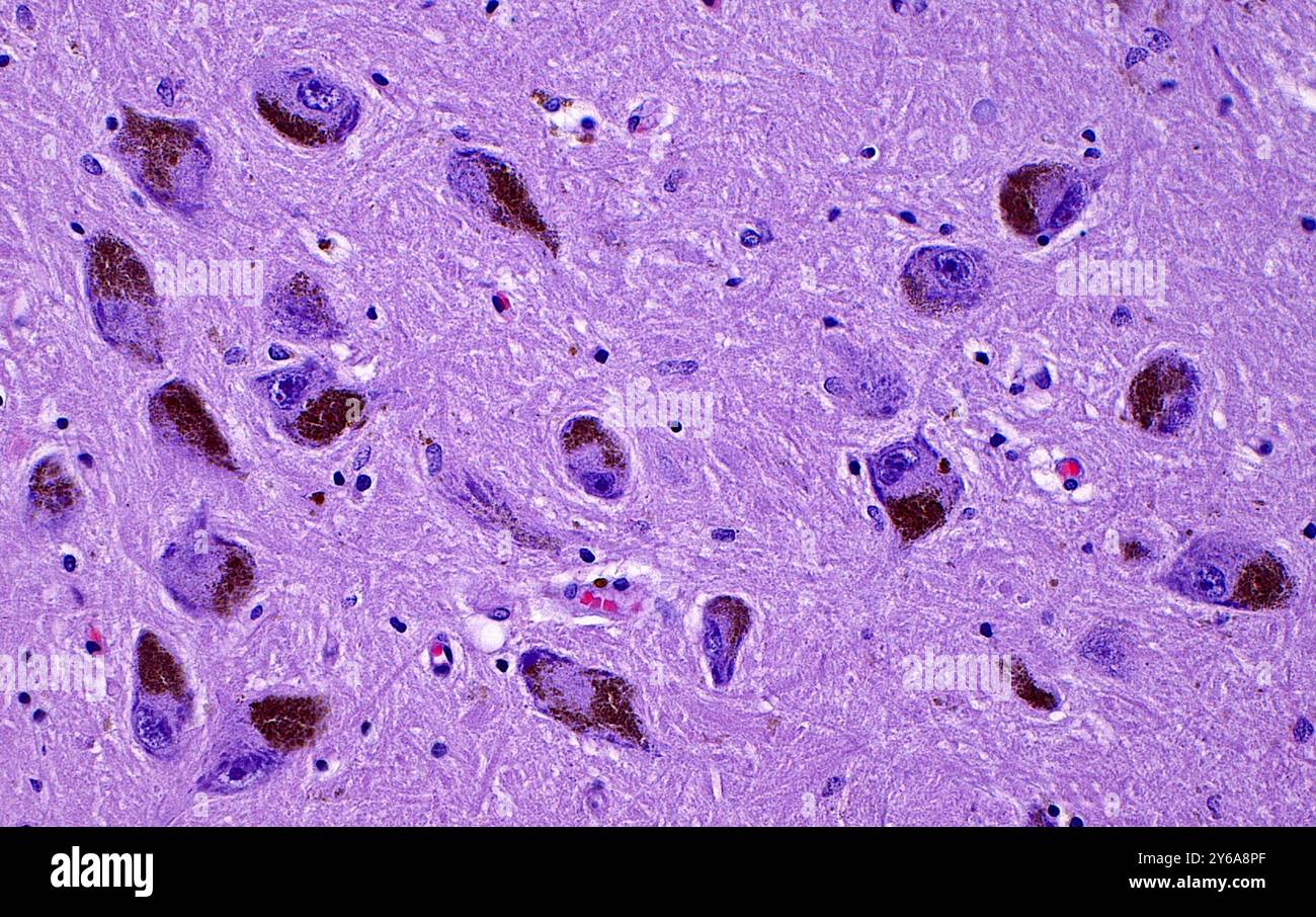 Light micrograph of neuron cell bodies in the substantia nigra of the ...