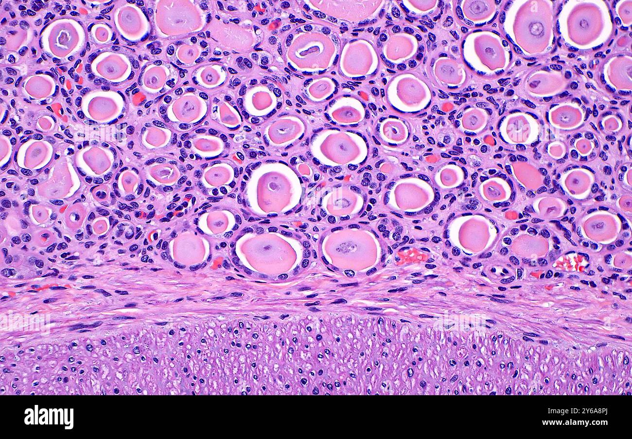 Light micrograph of thyroidisation of kidney tubules. Thyroidisation ...