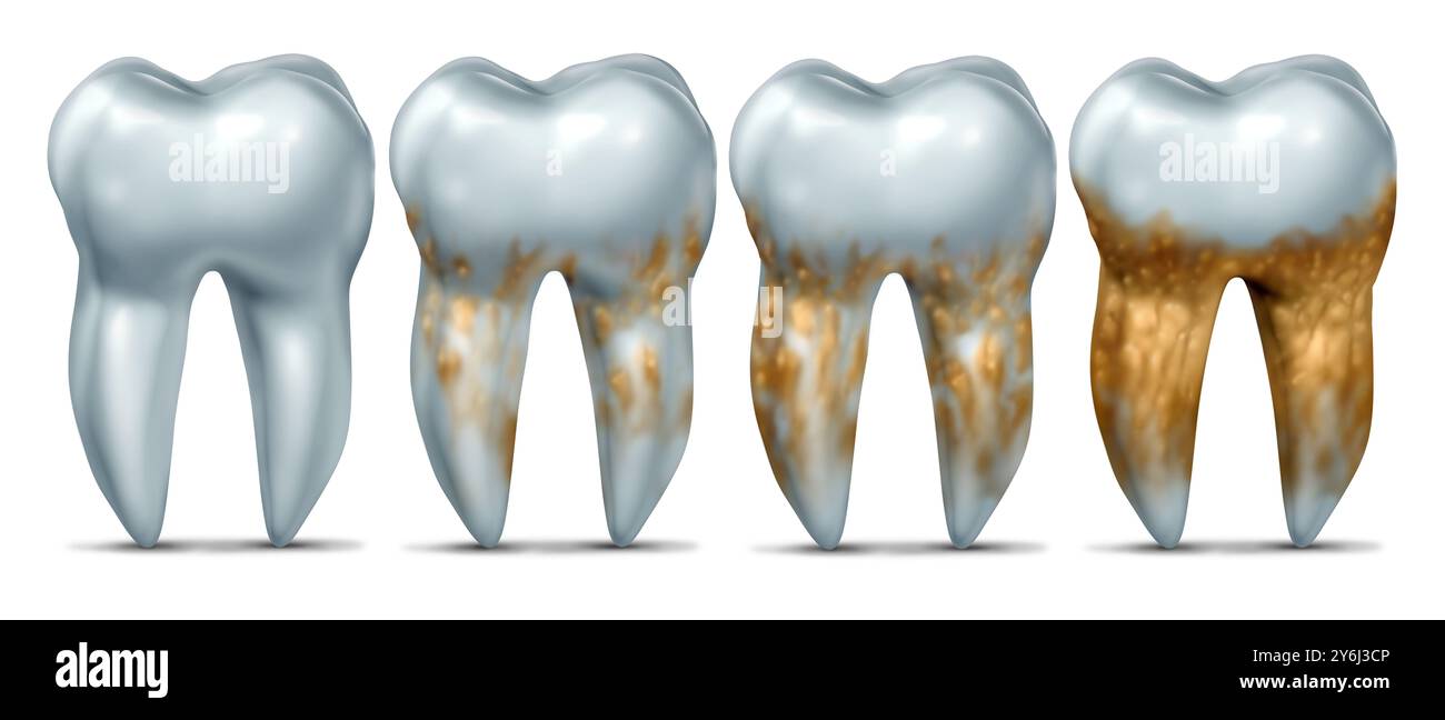 Tooth Disease Growth and dental infection as teeth decay disease as an ...