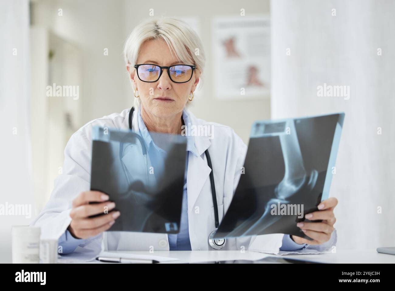 Doctor, thinking and xray assessment in hospital for healthcare ...