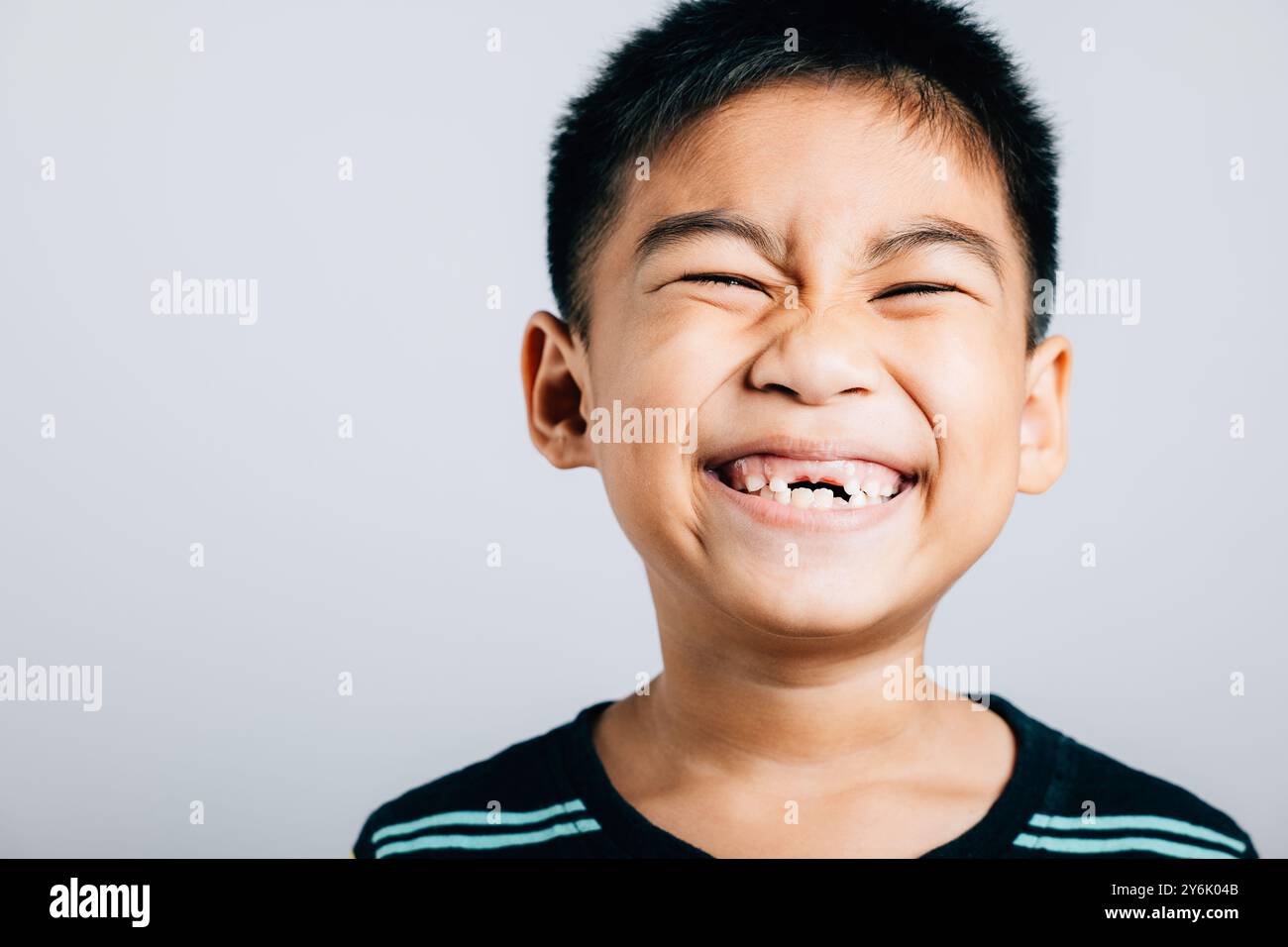 Child wide smile reveals gap from missing upper tooth. Dental ...