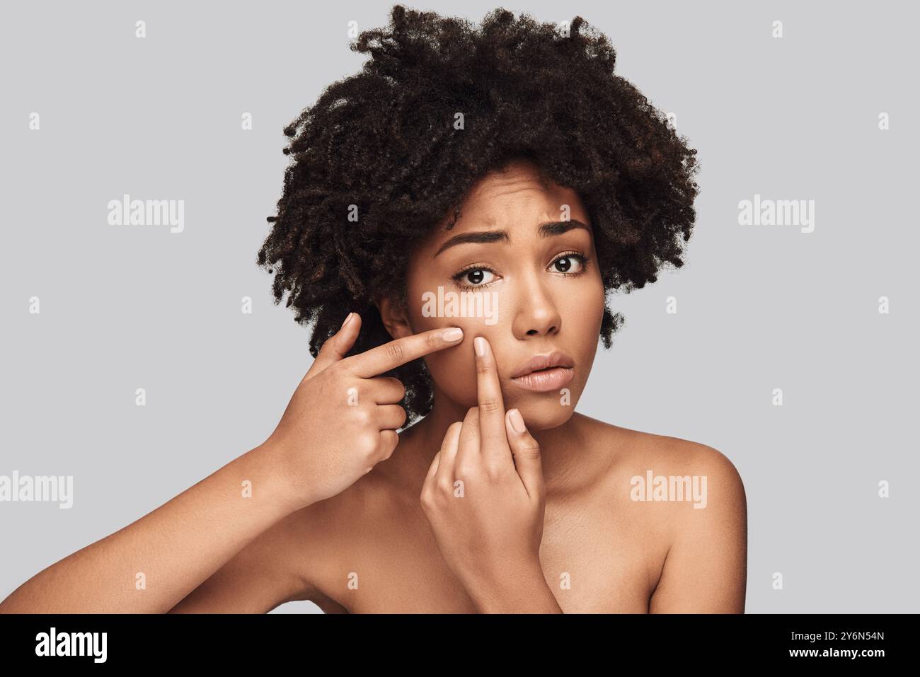 Another acne. Young sad African woman squeezing pimple while standing ...