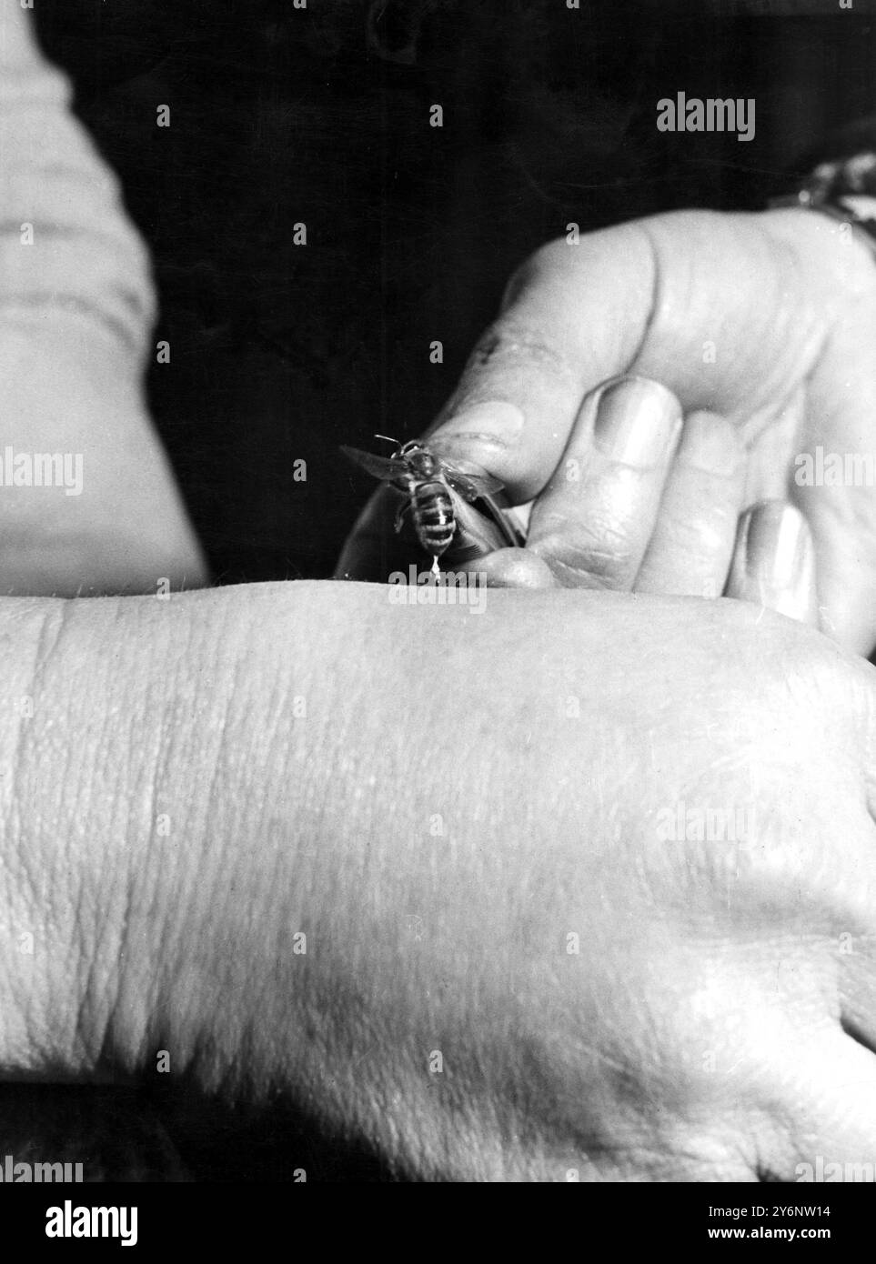Stung by bee Black and White Stock Photos & Images - Alamy