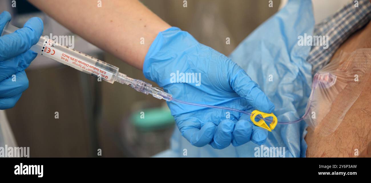 Close up of Nurse Holding line to port open whilst using flush - saline ...
