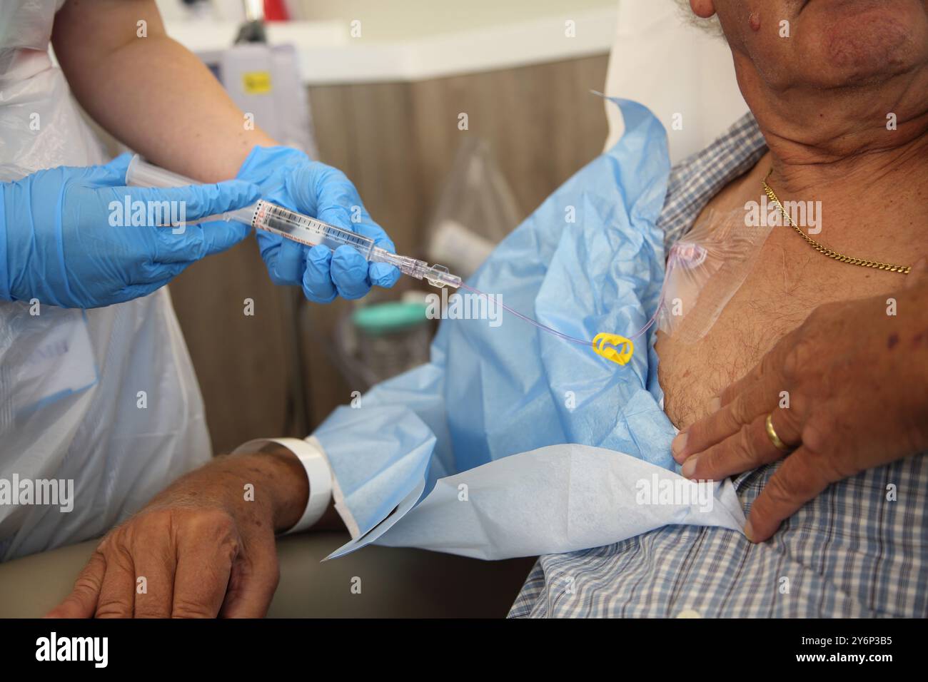 Implantable port hi-res stock photography and images - Alamy