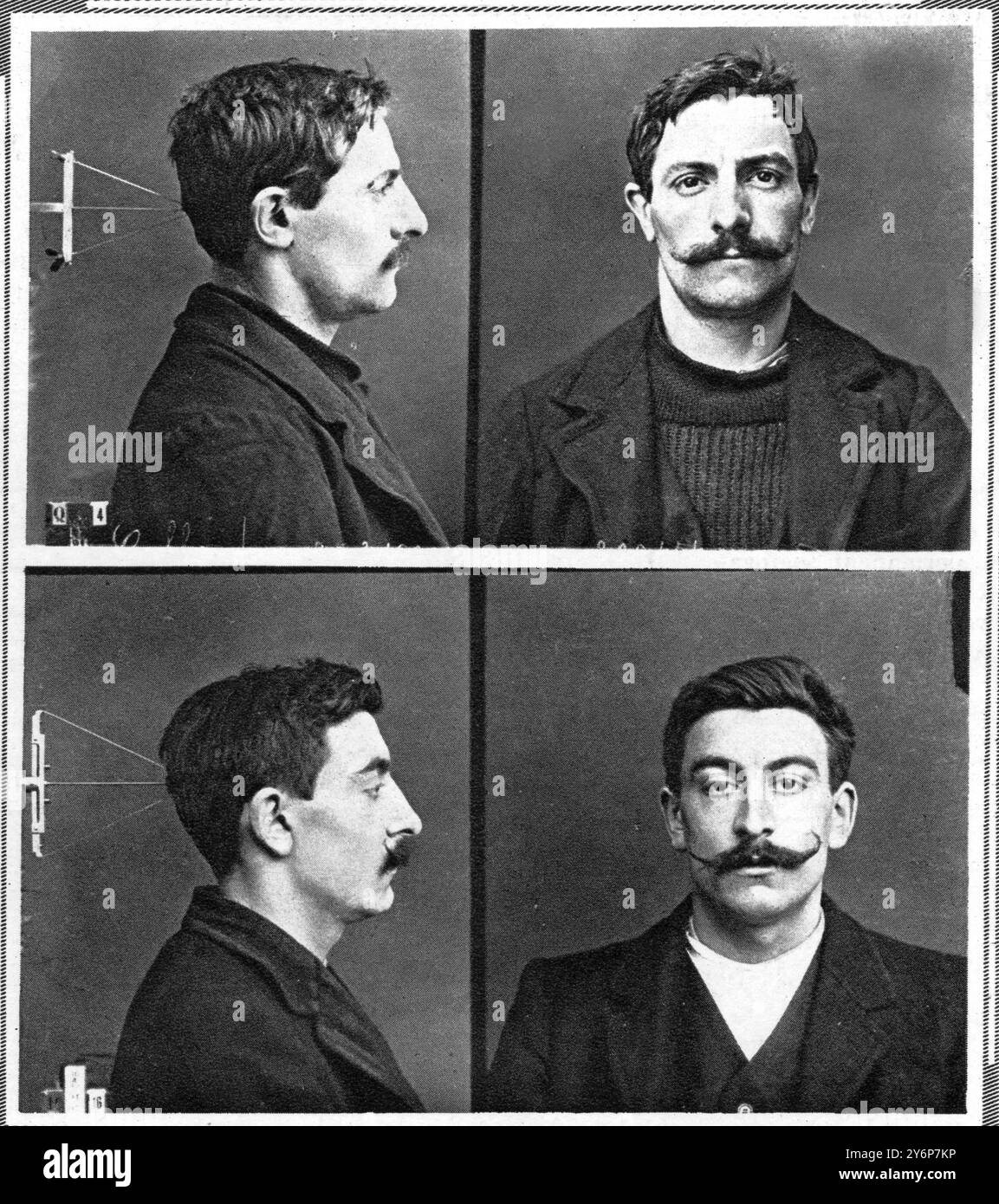 Mistaken identity established by differences in the ears, nose and adam ...