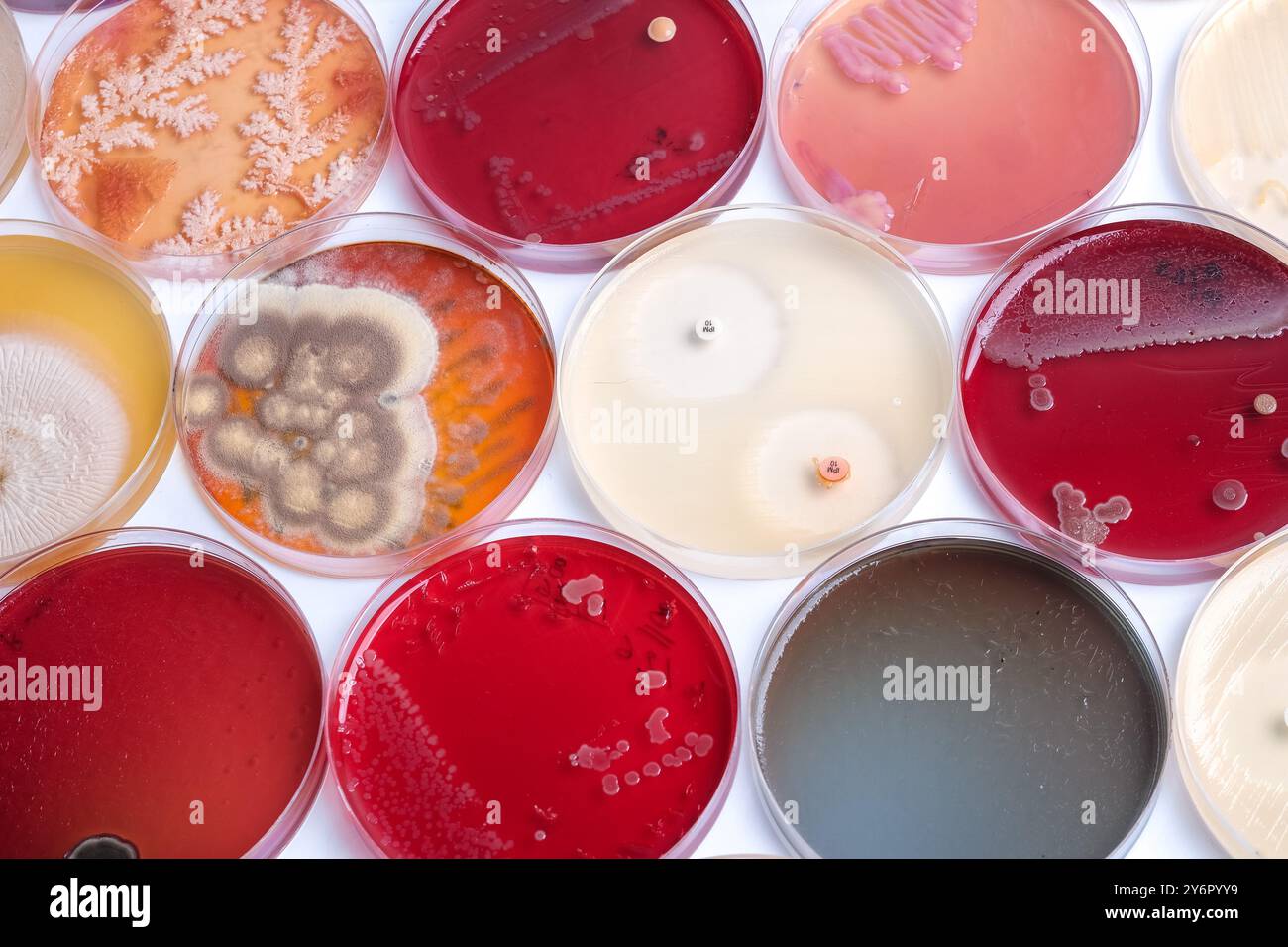 A variety of petri dishes showing different bacterial and fungal ...