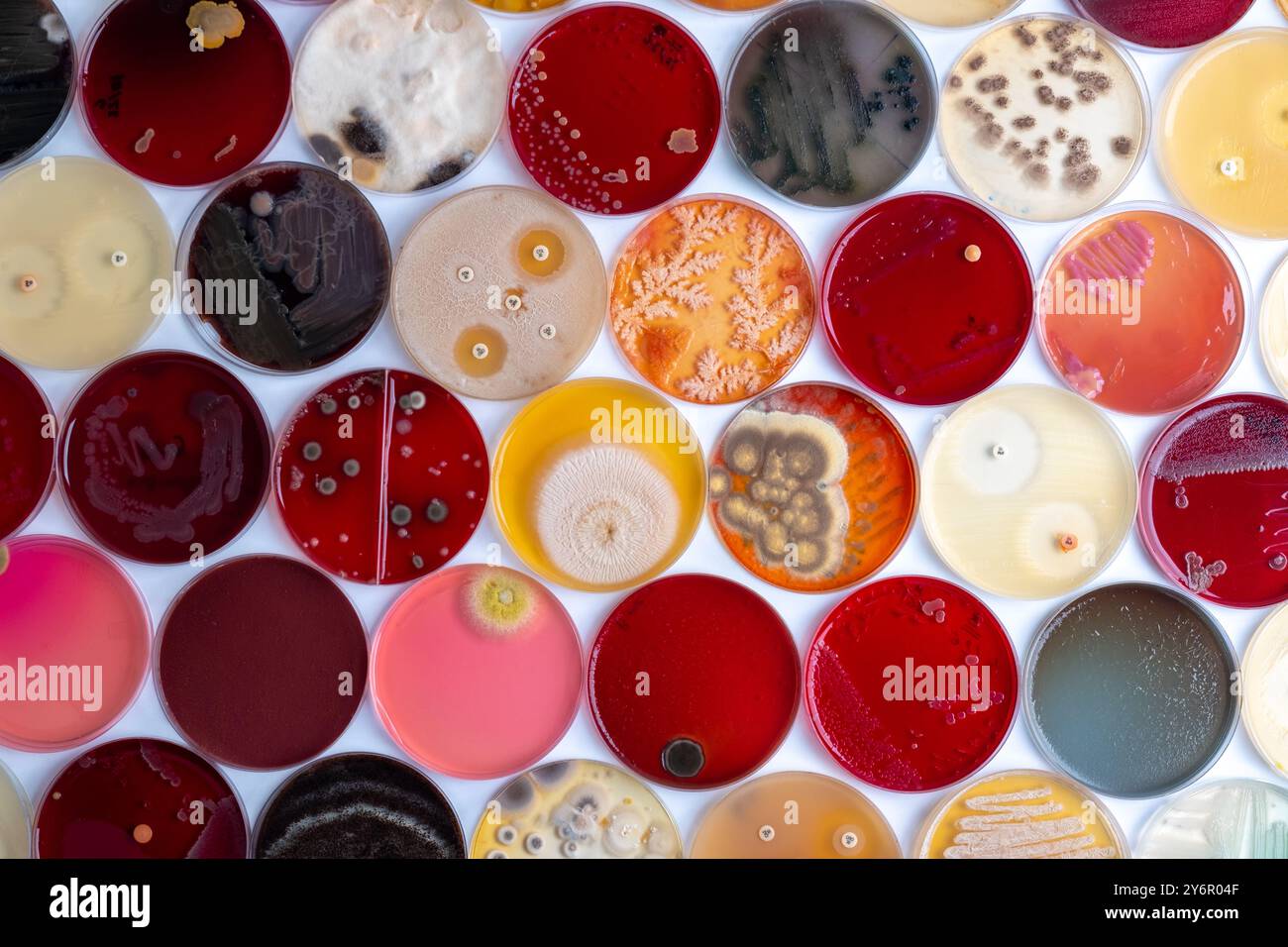 A collection of petri dishes with various bacteria cultures showcasing ...
